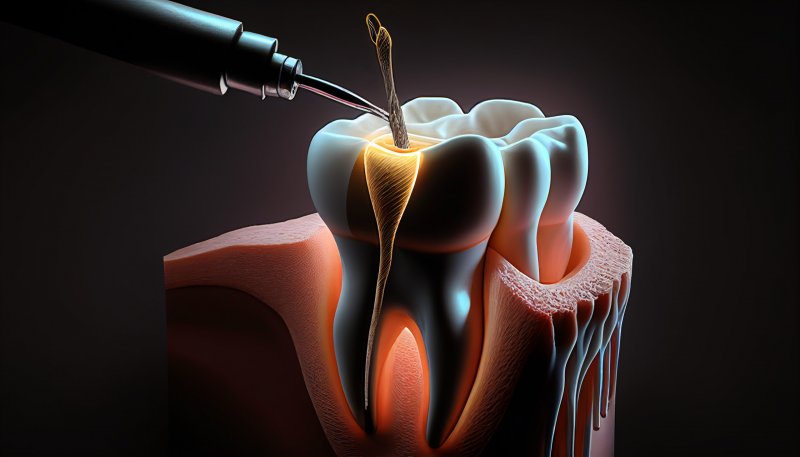 No Regrets: Why Getting a Root Canal is Worth It - Baldwin Family ...